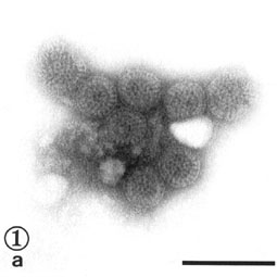 Seeing is Believing - Electron microscopy in diagnostic and biological ...